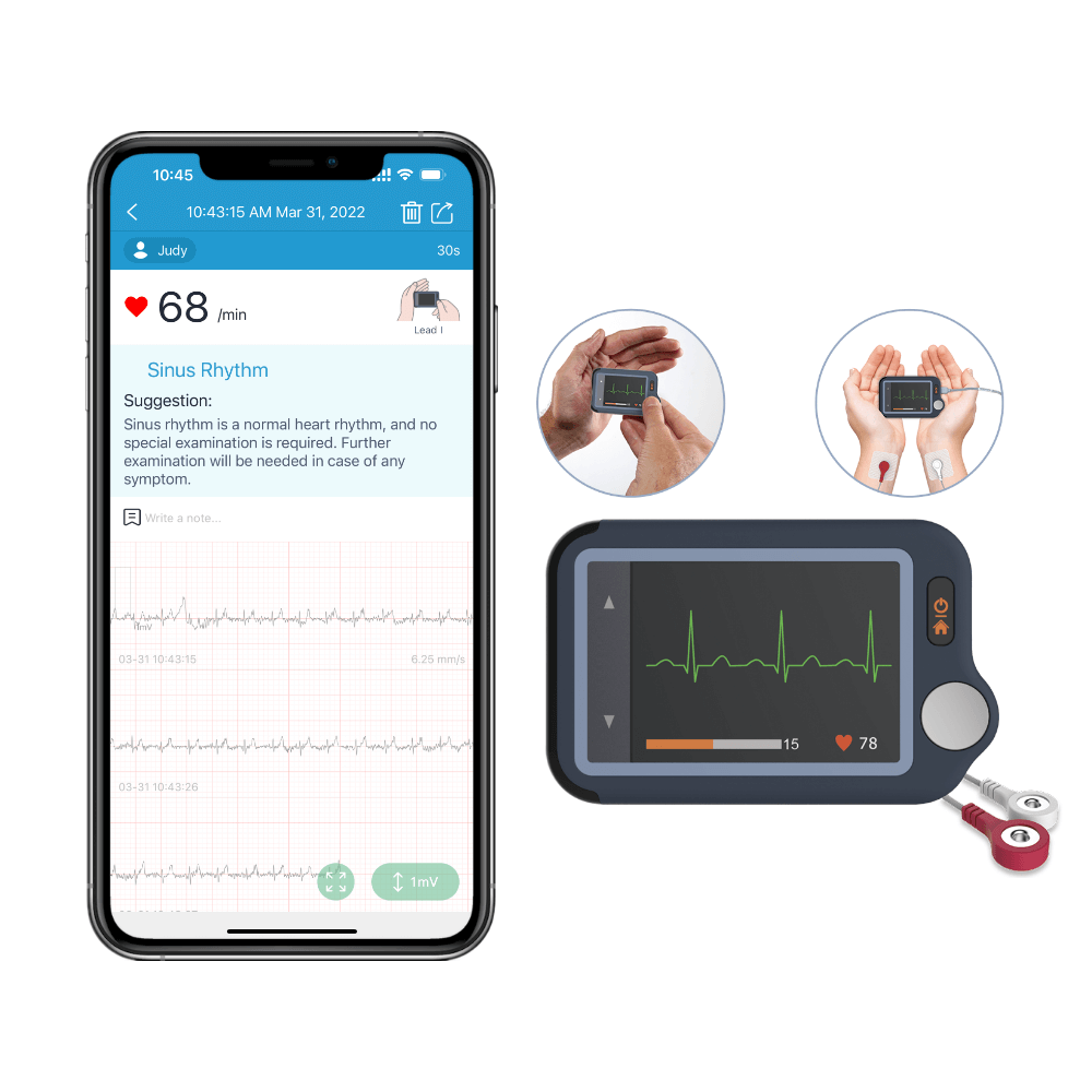 Personal ECG Monitor with AI Analysis - Get Your Heart Reports via Free ...